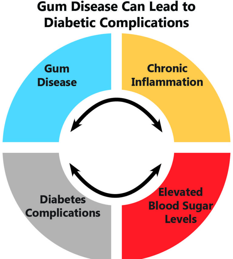 Diabetes and Oral Health – Dentist Downers Grove | General & Cosmetic ...
